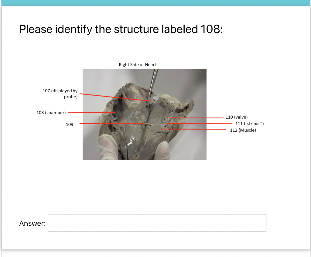 Solved Please identify the structure labeled 108: | Chegg.com