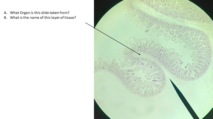 Solved A. What Organ is this slide taken from? B. What is | Chegg.com