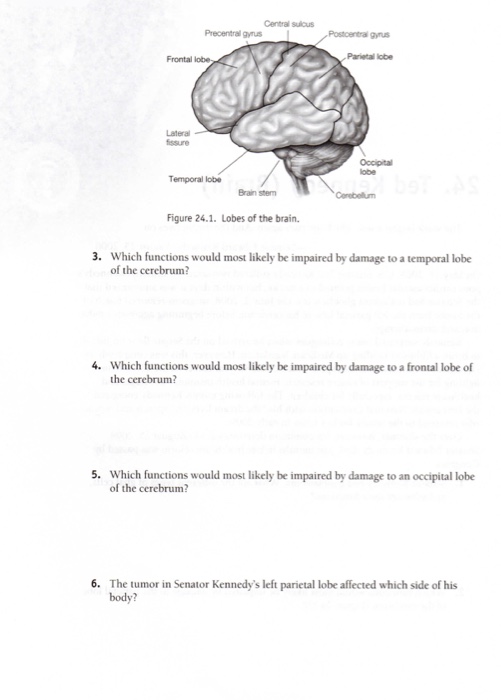 Solved 24. Ted Kennedy (Brain) The work begins anew. The | Chegg.com