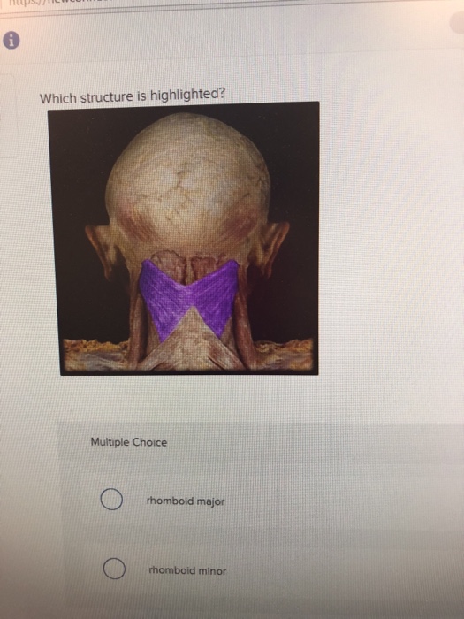 Solved Which structure is highlighted? Multiple Choice | Chegg.com