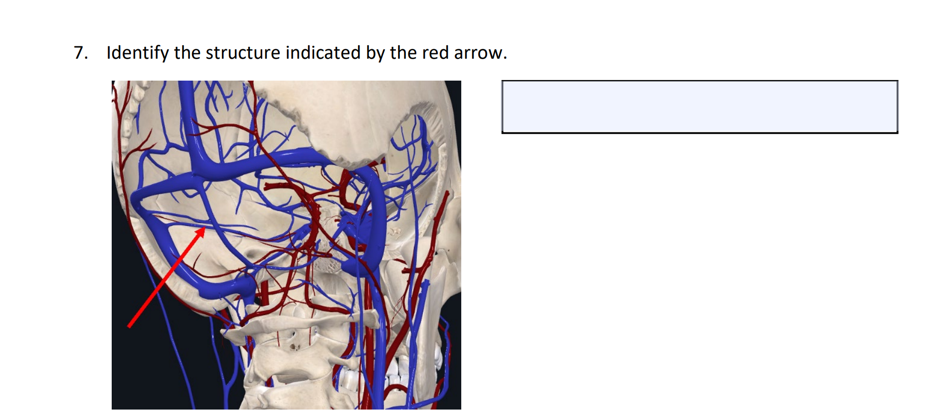 7. Identify the structure indicated by the red arrow. | Chegg.com