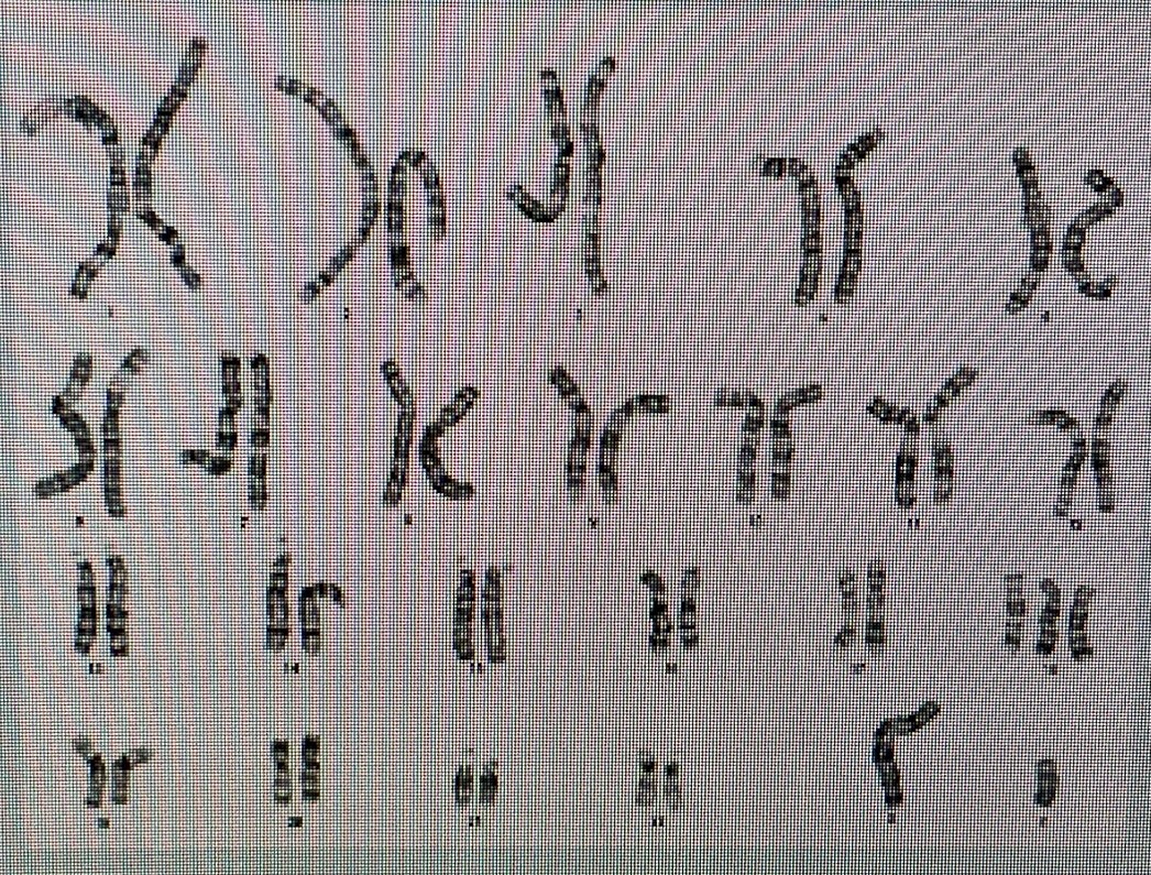 Solved The karyotype below would be an example of a/an | Chegg.com