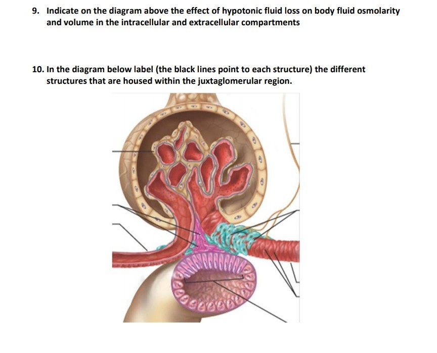 Solved 9. Indicate on the diagram above the effect of | Chegg.com