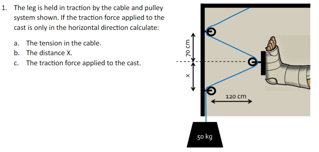 Solved The leg is held in traction by the cable and | Chegg.com
