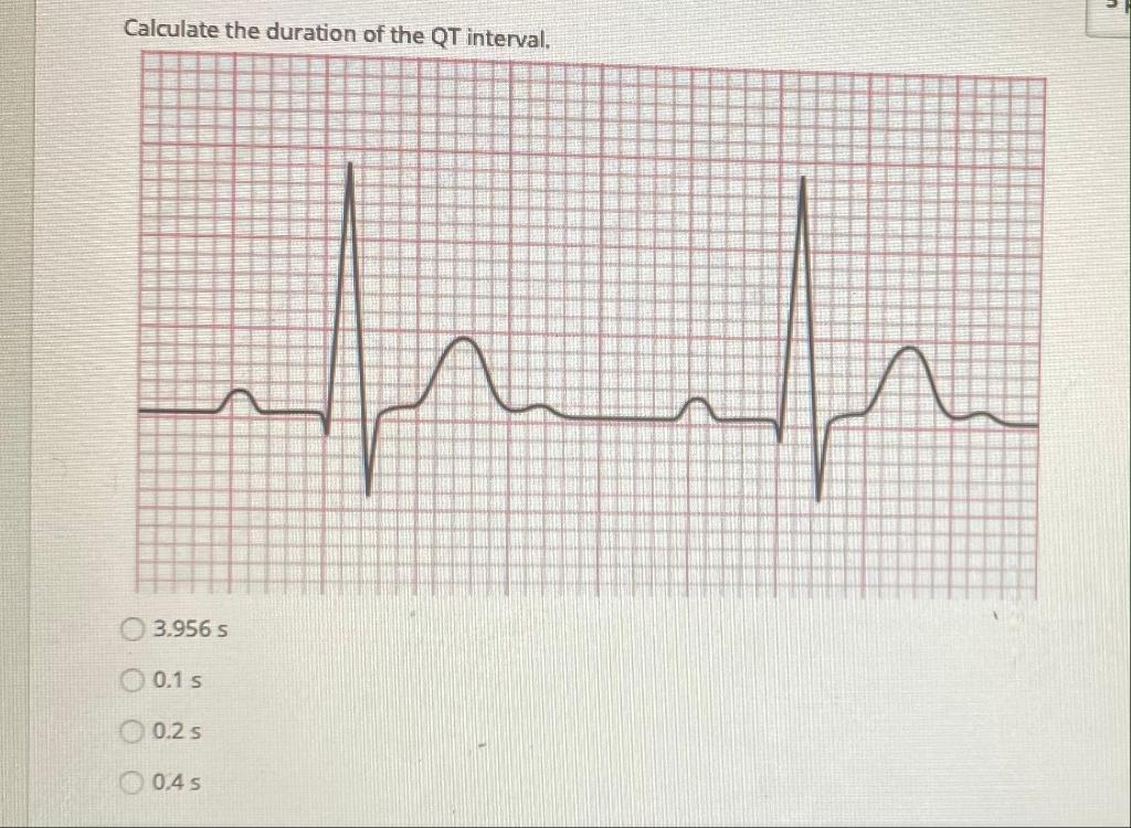 Solved 1a.) Calculate the duration of the QT interval. | Chegg.com