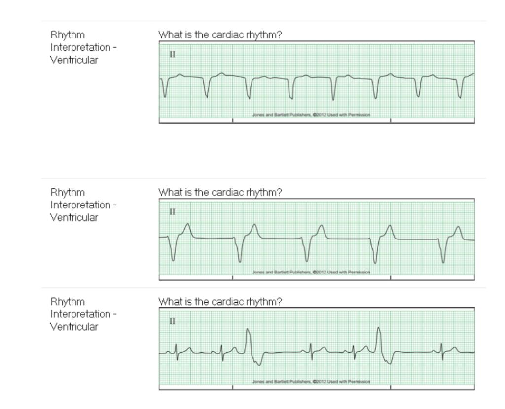 Solved What is the correct cardiac rhythm strip answers? | Chegg.com