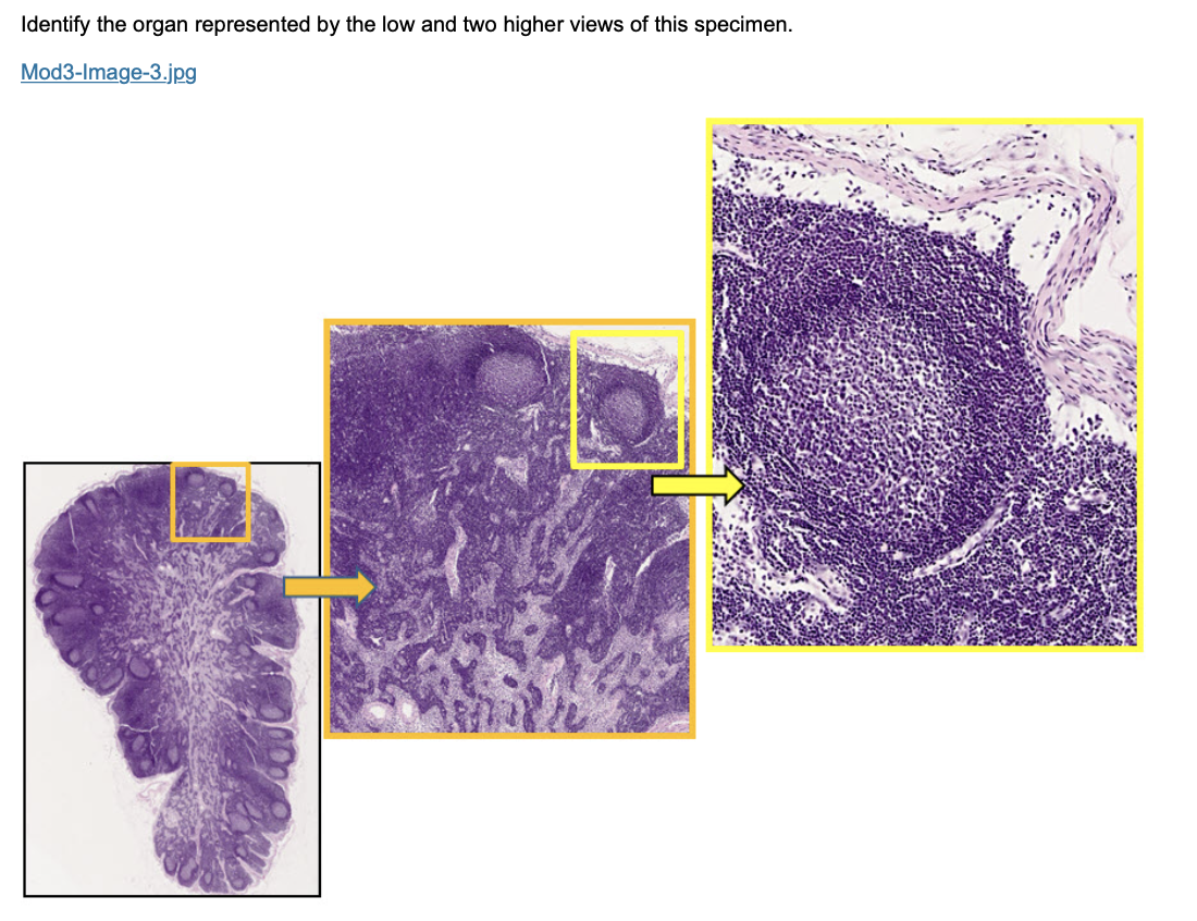 [Solved]: Identify the organ represented by the low and t