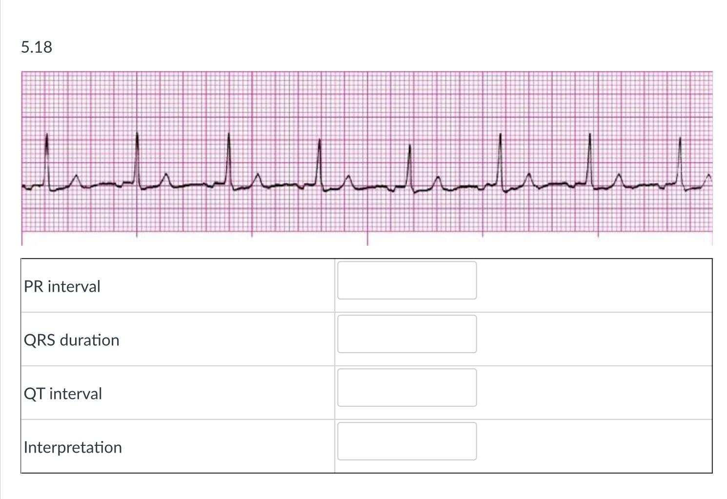 Solved 5.18 PR interval QRS duration QT interval | Chegg.com