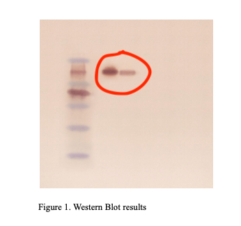 Solved The top image is the results of our western blot lab. | Chegg.com
