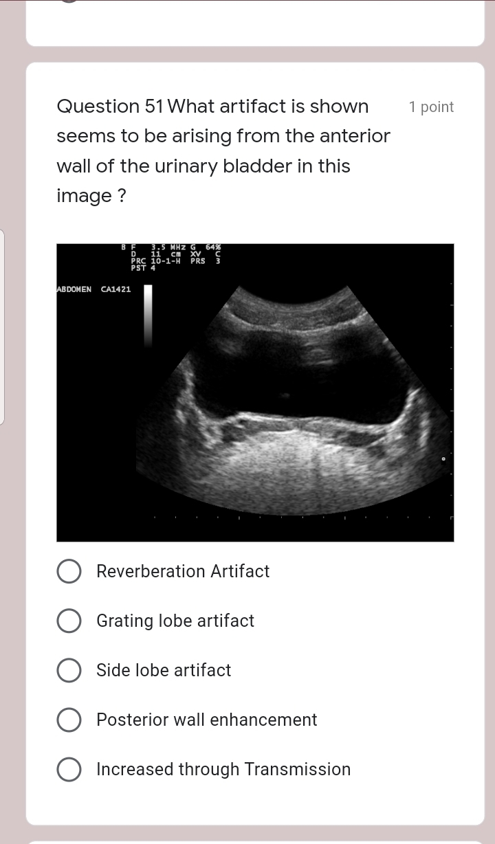 Solved 1 point Question 51 What artifact is shown seems to | Chegg.com