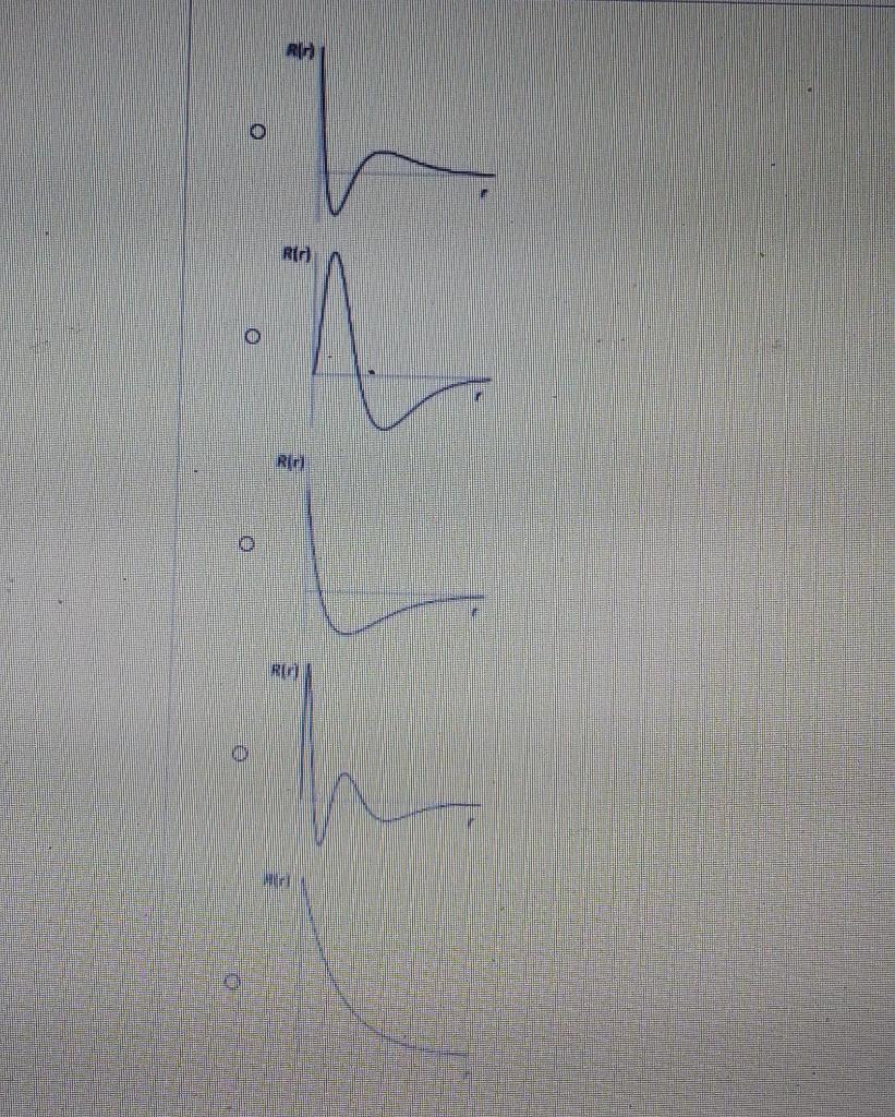 Solved Which of the following best represents the radial | Chegg.com