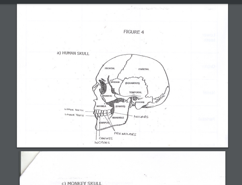 Solved FIGURE 4 a) HUMAN SKULL FRONTAL PARIETAL SINOD | Chegg.com