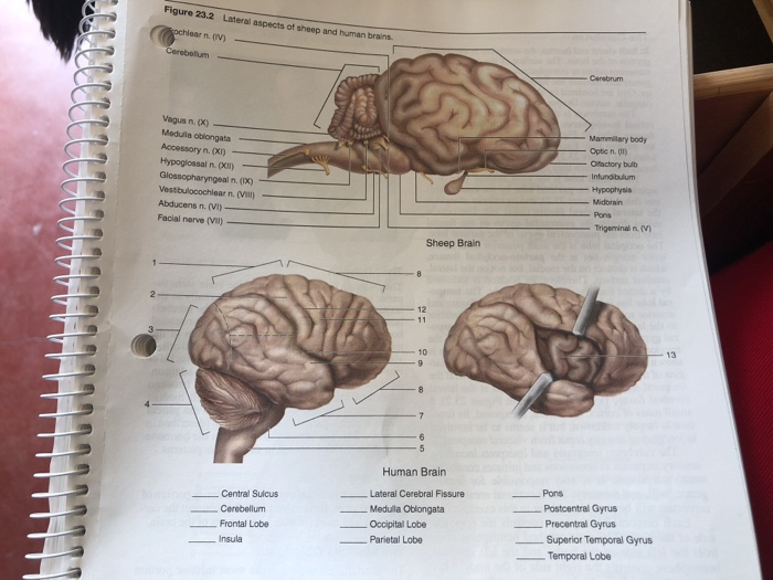 Lateral Aspect Of The Brain