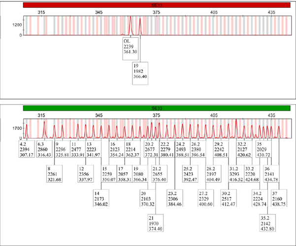Solved Using the following electropherogram, determine the | Chegg.com