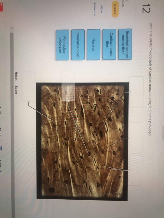 Solved abel the photomicrograph of cardiac muscle using the | Chegg.com