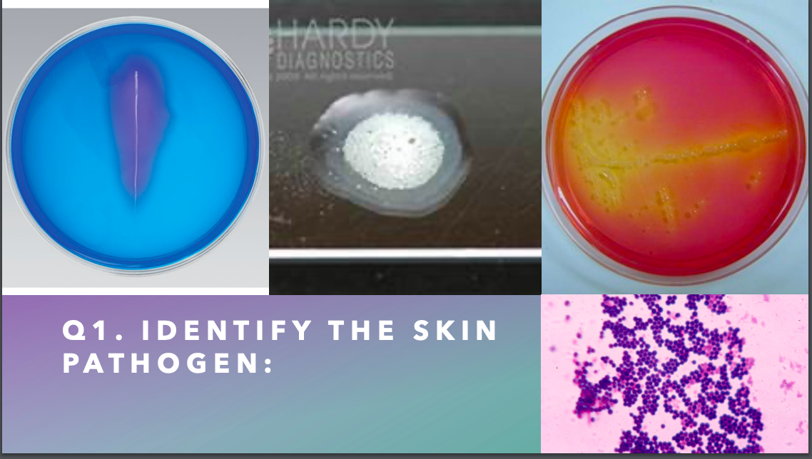 Solved Q1. IDENTIFY THE SKIN PATHOGEN : | Chegg.com