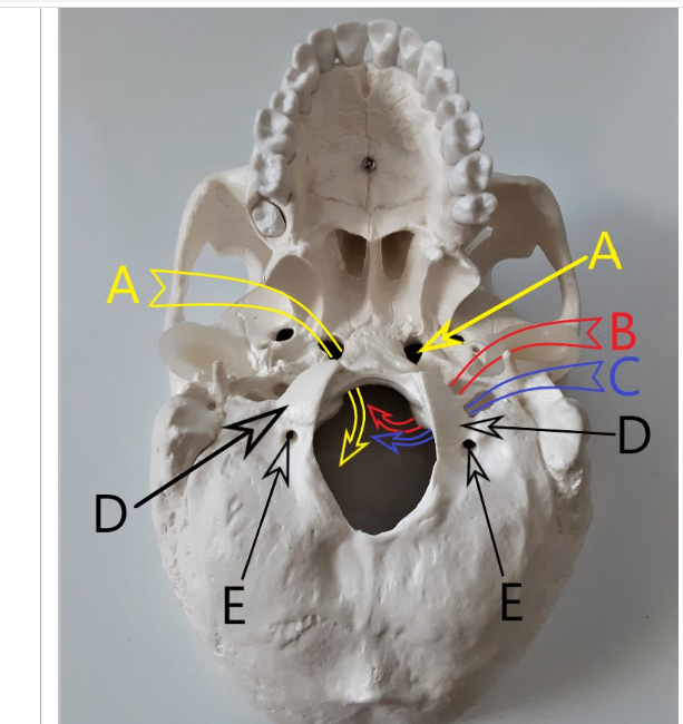 Solved 1.The projection "A" is [ Select ] ["zygomatic | Chegg.com