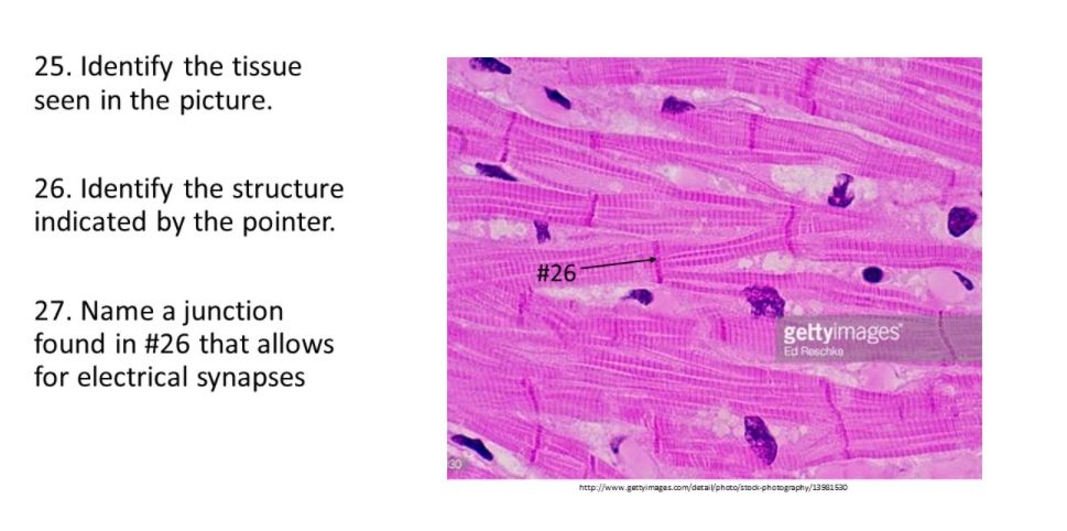 Solved 18. Identify the structure indicated by the pointer. | Chegg.com