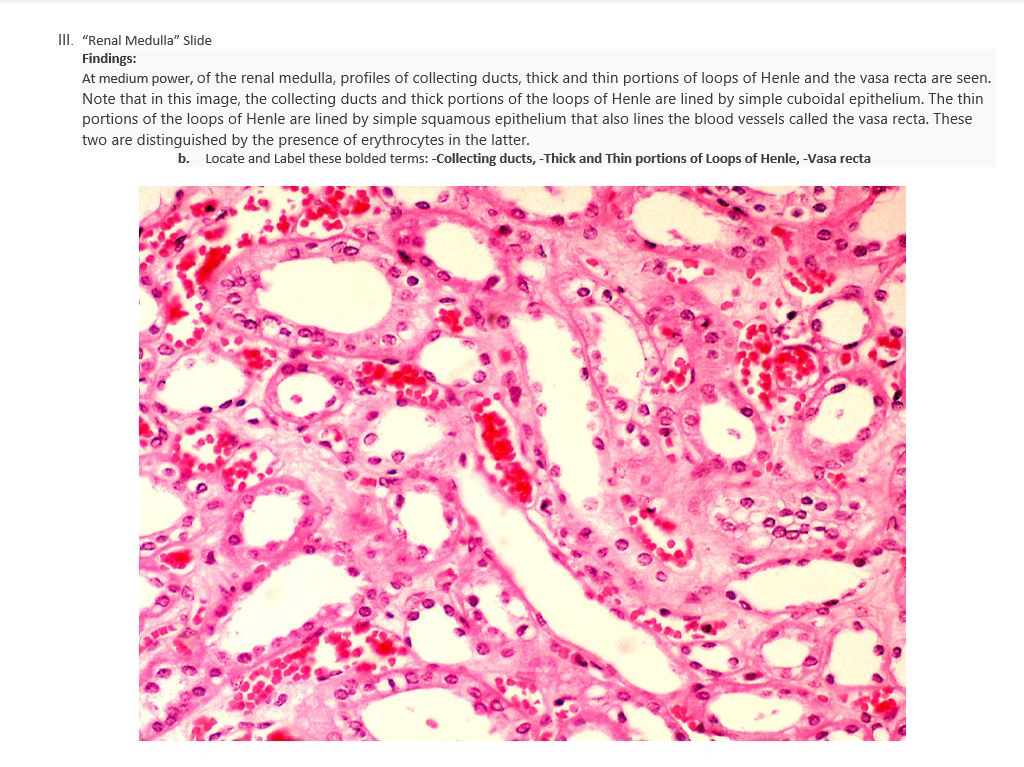 Solved III. "Renal Medulla" Slide Findings: At medium power, | Chegg.com