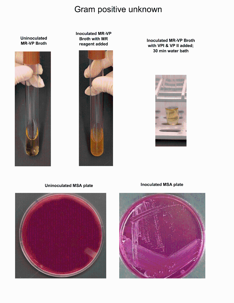 Gram positive unknown Uninoculated MR-VP Broth | Chegg.com