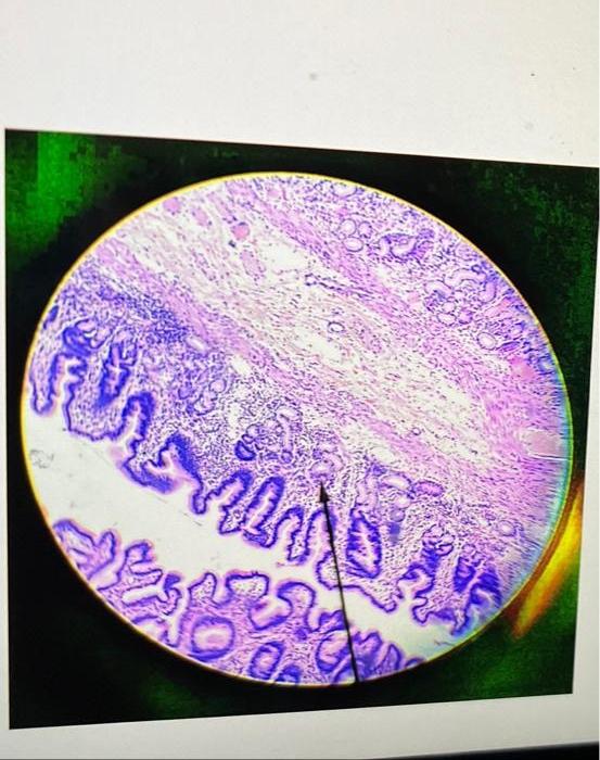 Solved Identify this histology drawing | Chegg.com