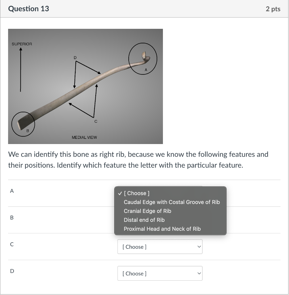 Solved Name the feature that is highlighted Manubrium | Chegg.com