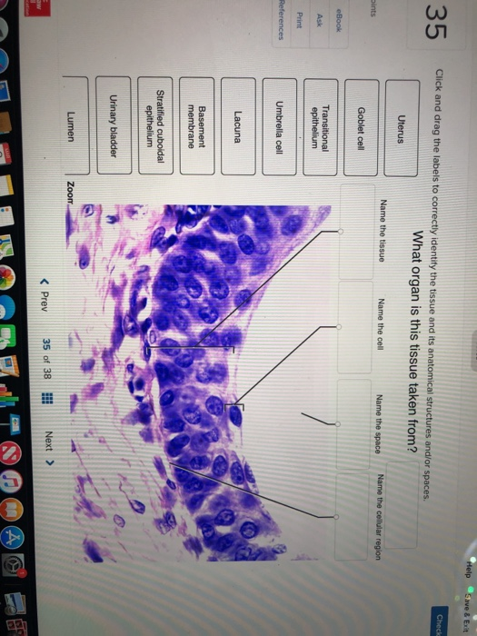 Solved Click and drag the labels to correctly identify the | Chegg.com
