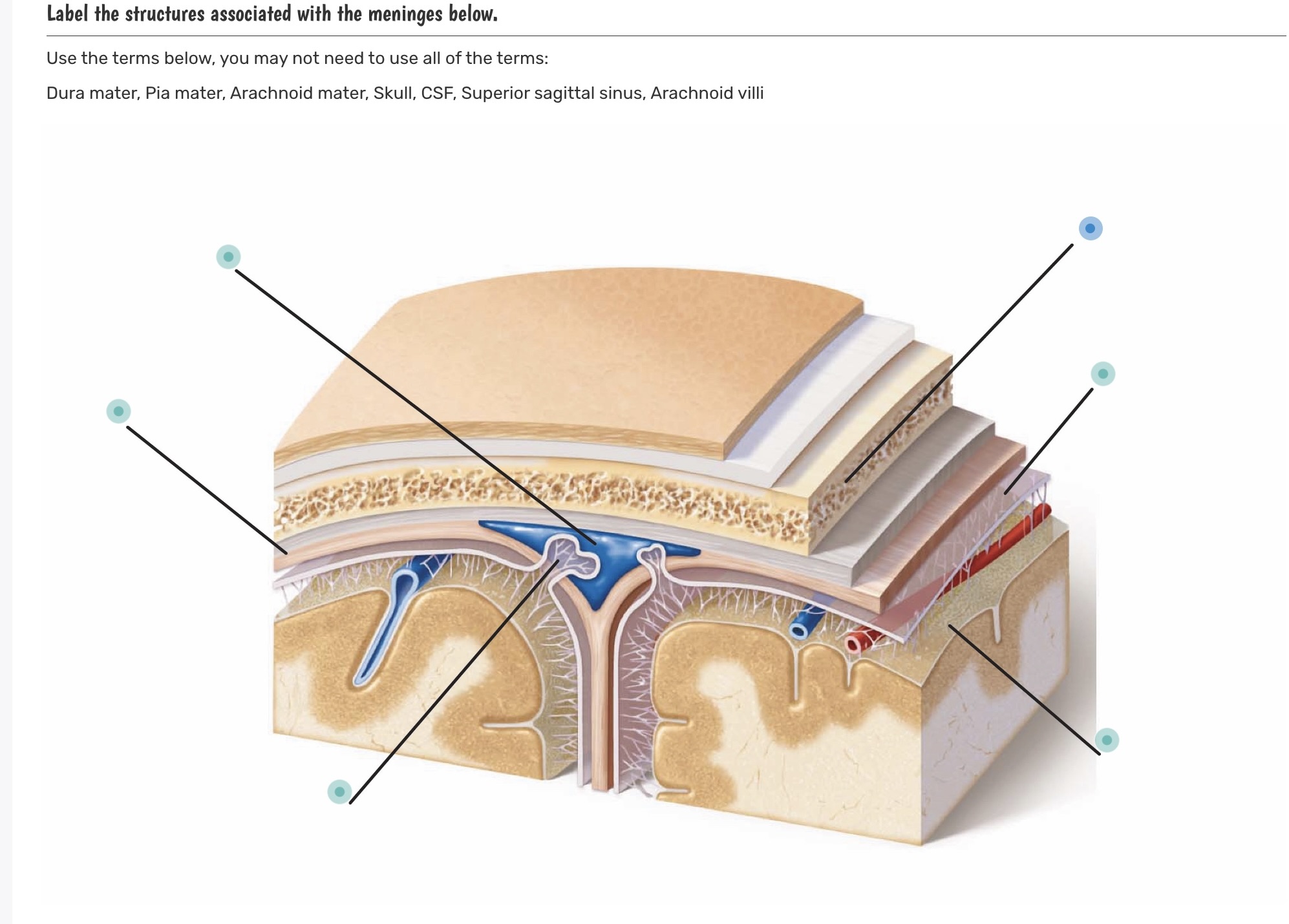 Solved Label the structures associated with the meninges | Chegg.com
