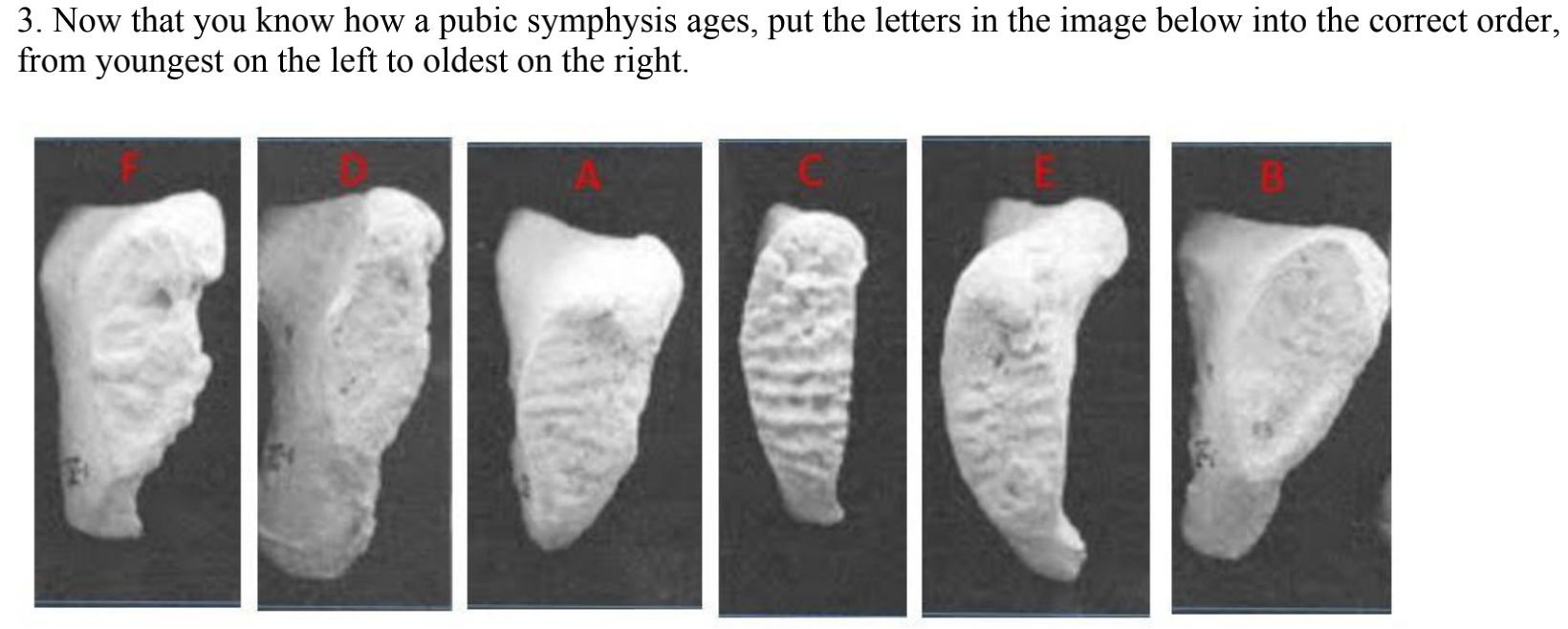 Pubic Symphysis Age