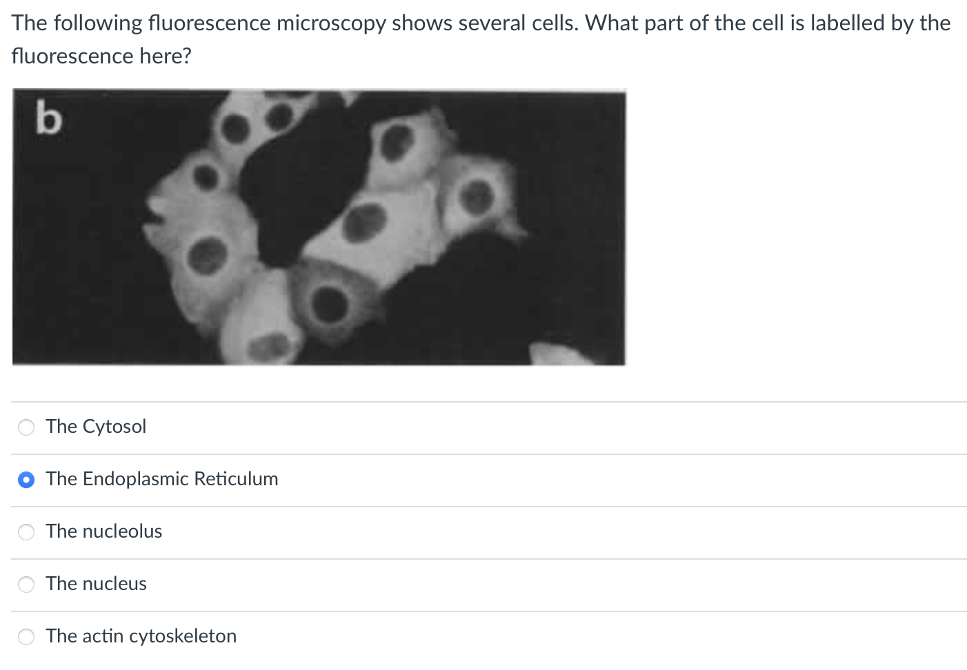 Solved The following fluorescence microscopy shows several | Chegg.com