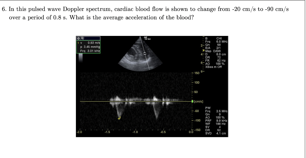 Solved 6. In this pulsed wave Doppler spectrum, cardiac | Chegg.com