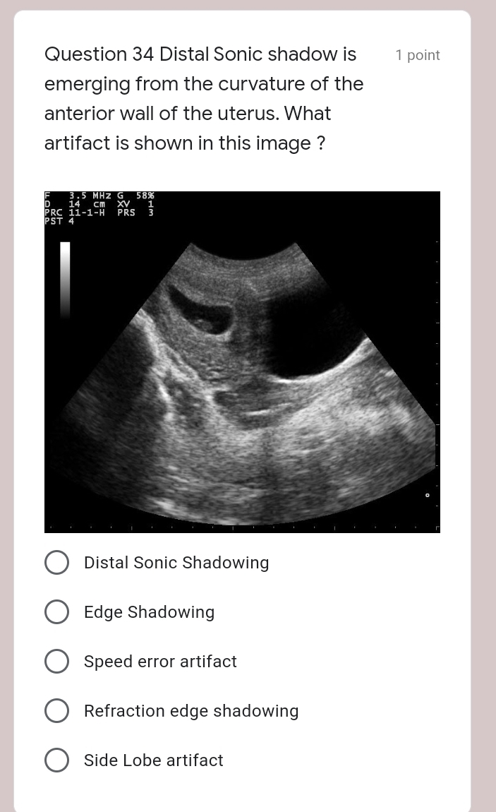 Solved 1 point Question 34 Distal Sonic shadow is emerging | Chegg.com