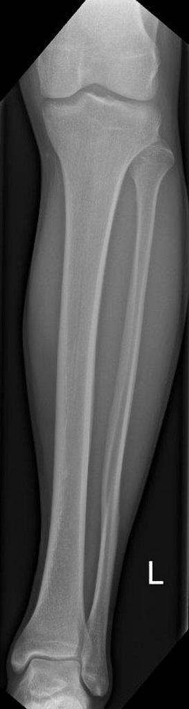 Solved according to paceman guidlines (a type of imaging | Chegg.com