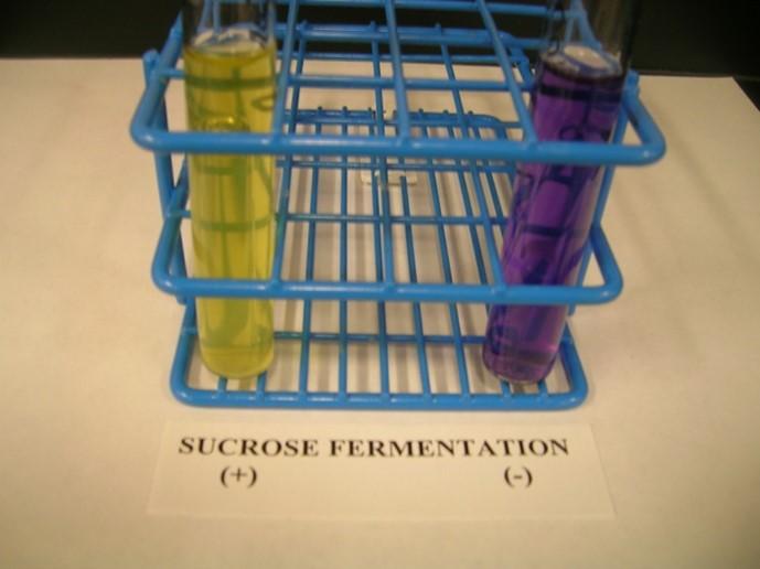 7. Record results for glucose, lactose, sucrose, and | Chegg.com