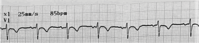 matlab A. Plot ECG from the attached PNG file. B. | Chegg.com