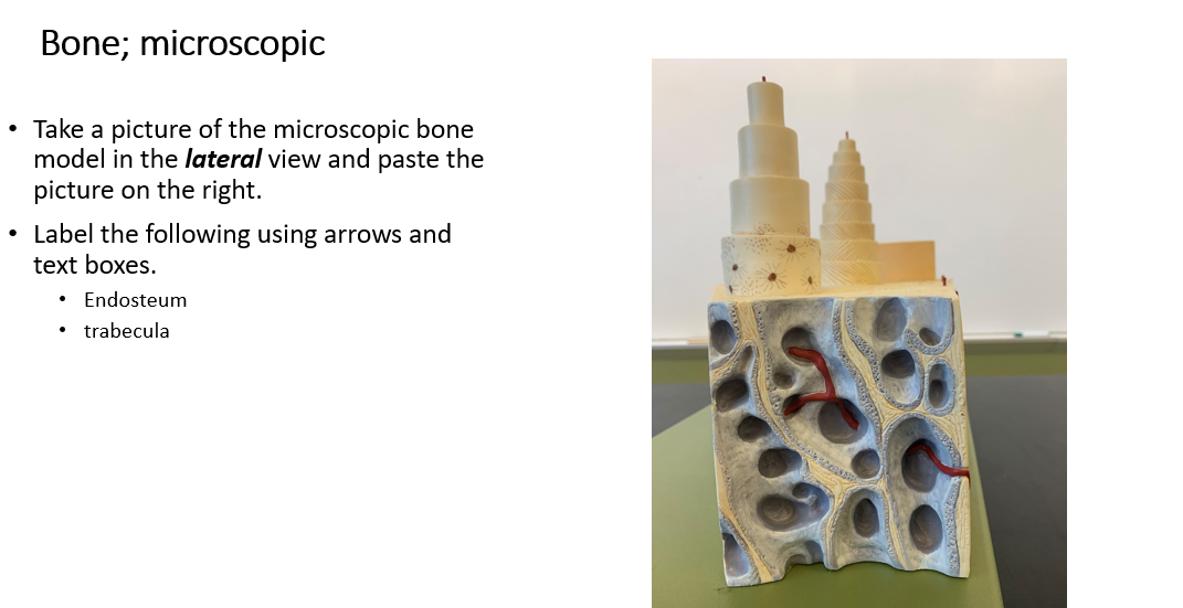 Solved Bone; microscopic - Take a picture of the microscopic | Chegg.com