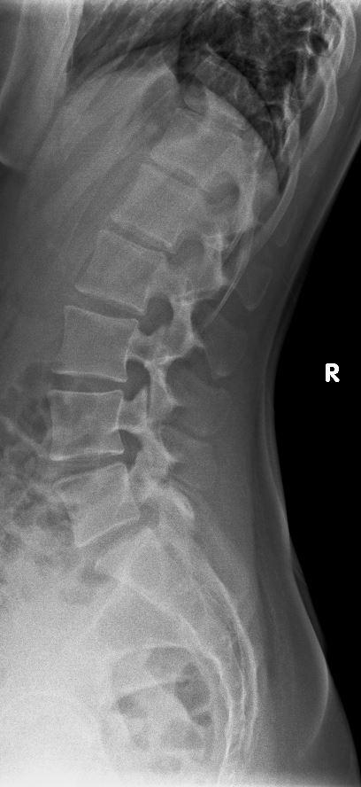 Solved Give exact location of the L3 inferior articulating | Chegg.com
