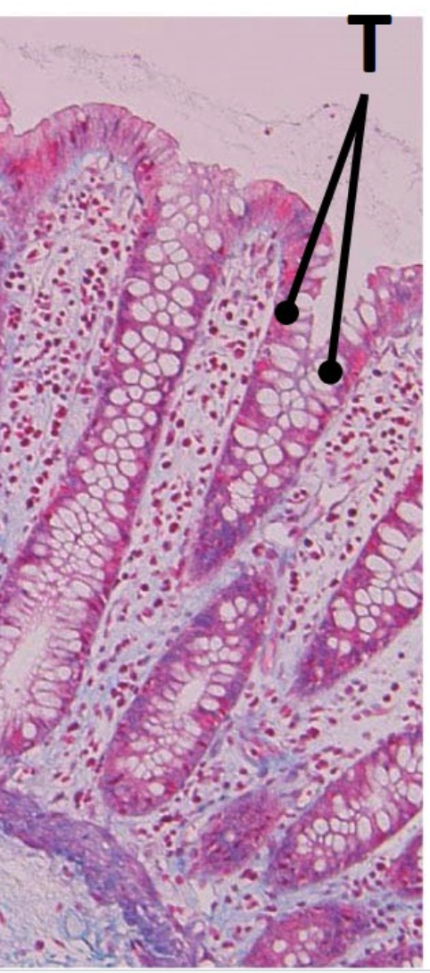 Gastroesophageal Junction Slide Labeled