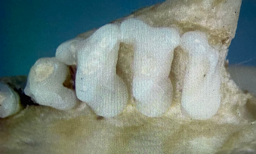 Solved 1. Which parts of the tribosphenic molar are involved | Chegg.com