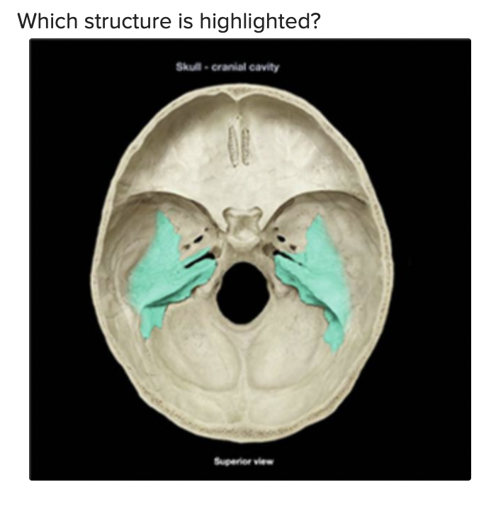 Internal Acoustic Meatus