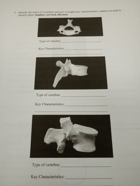Solved Identify the types of vertebrae and give a couple key | Chegg.com