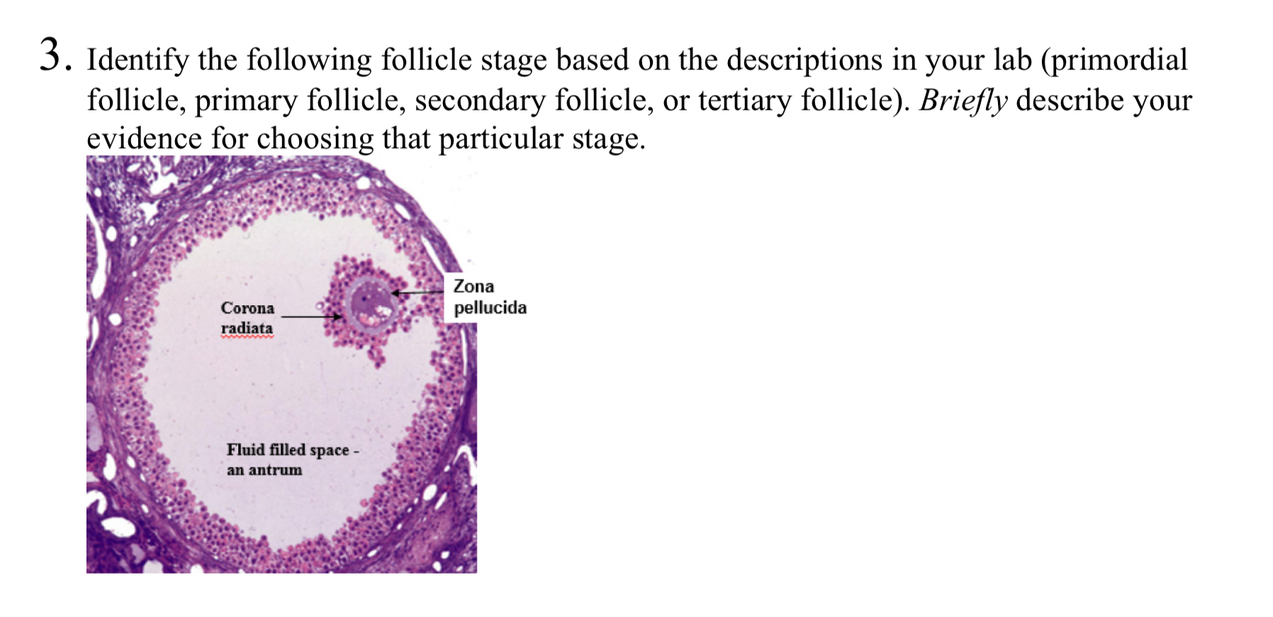 Solved Identify the following follicle stage based on the | Chegg.com
