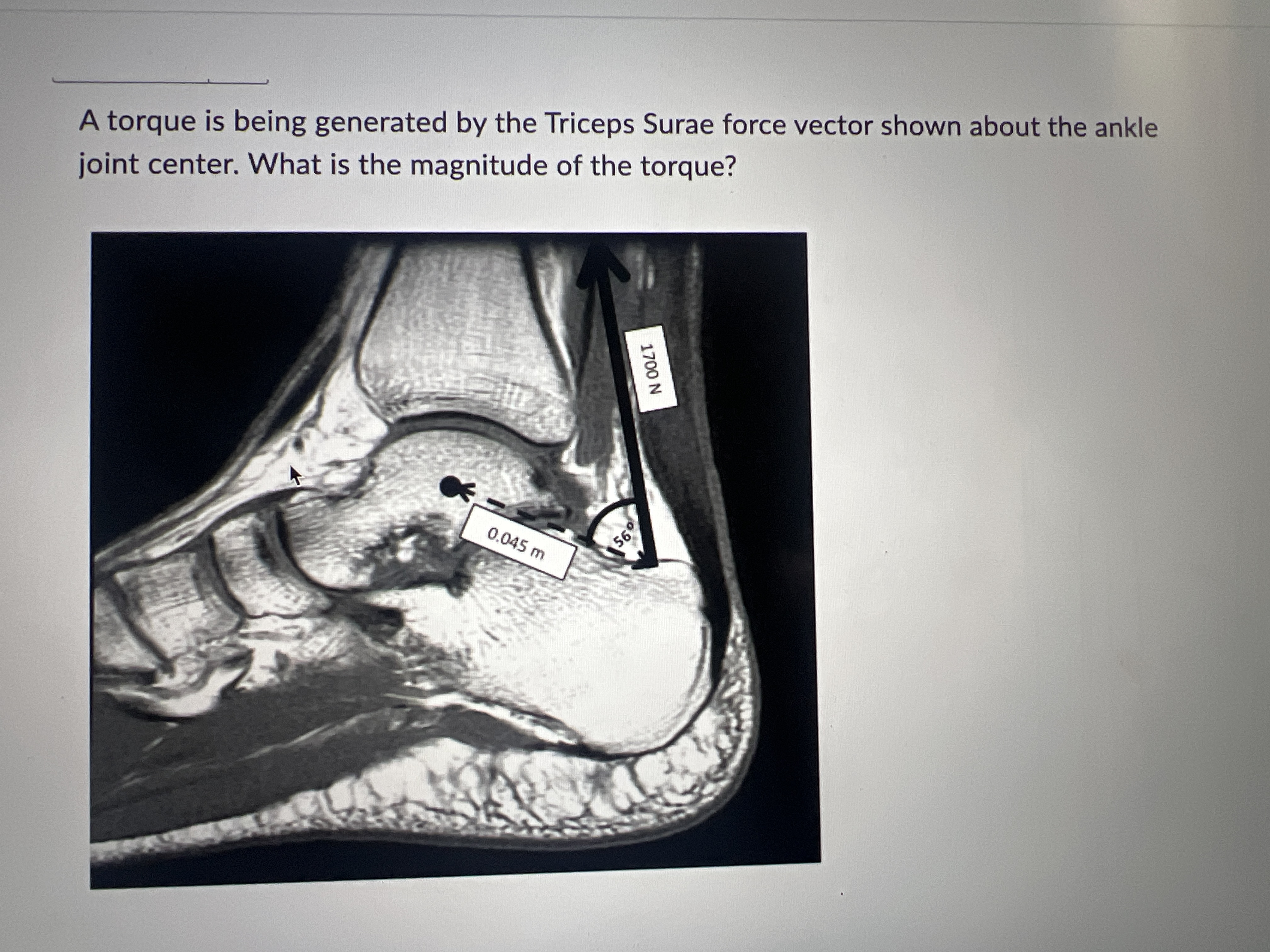 Solved A torque is being generated by the Triceps Surae | Chegg.com