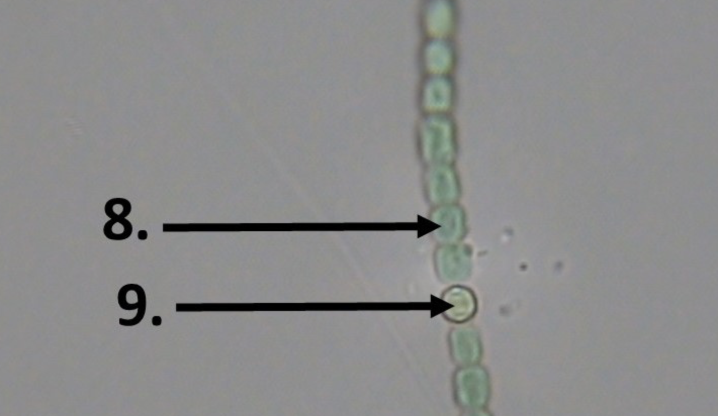 Anabaena Under Microscope Labeled