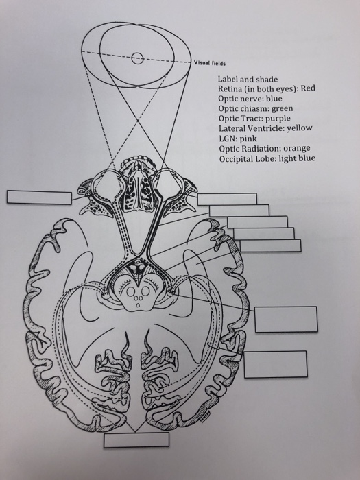 Solved - ? visual fields Label and shade Retina (in both | Chegg.com