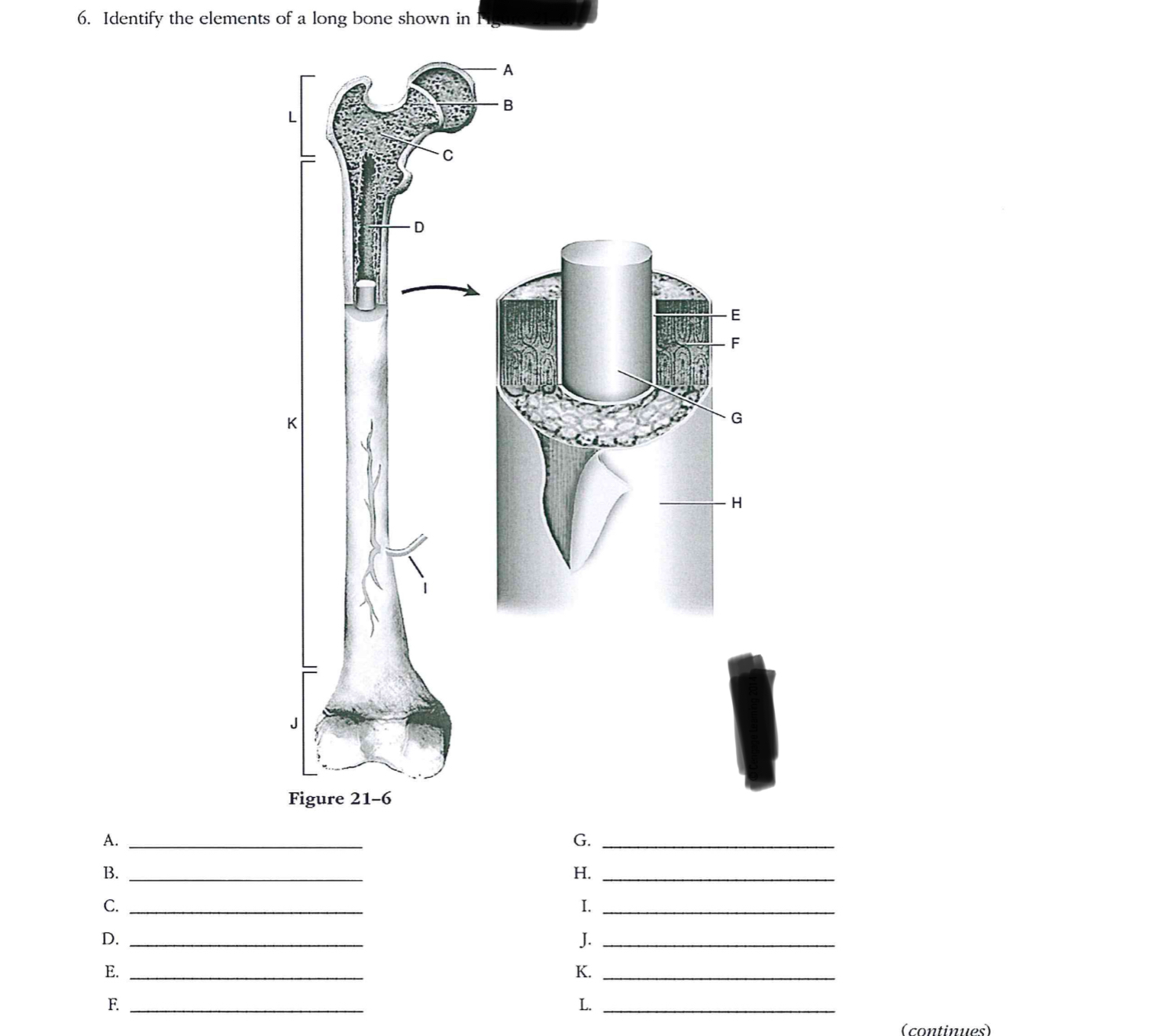 Solved 6. Identify the elements of a long bone shown in A. | Chegg.com