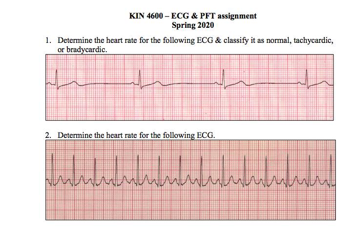 KIN 4600 - ECG & PFT assignment Spring 2020 1. | Chegg.com