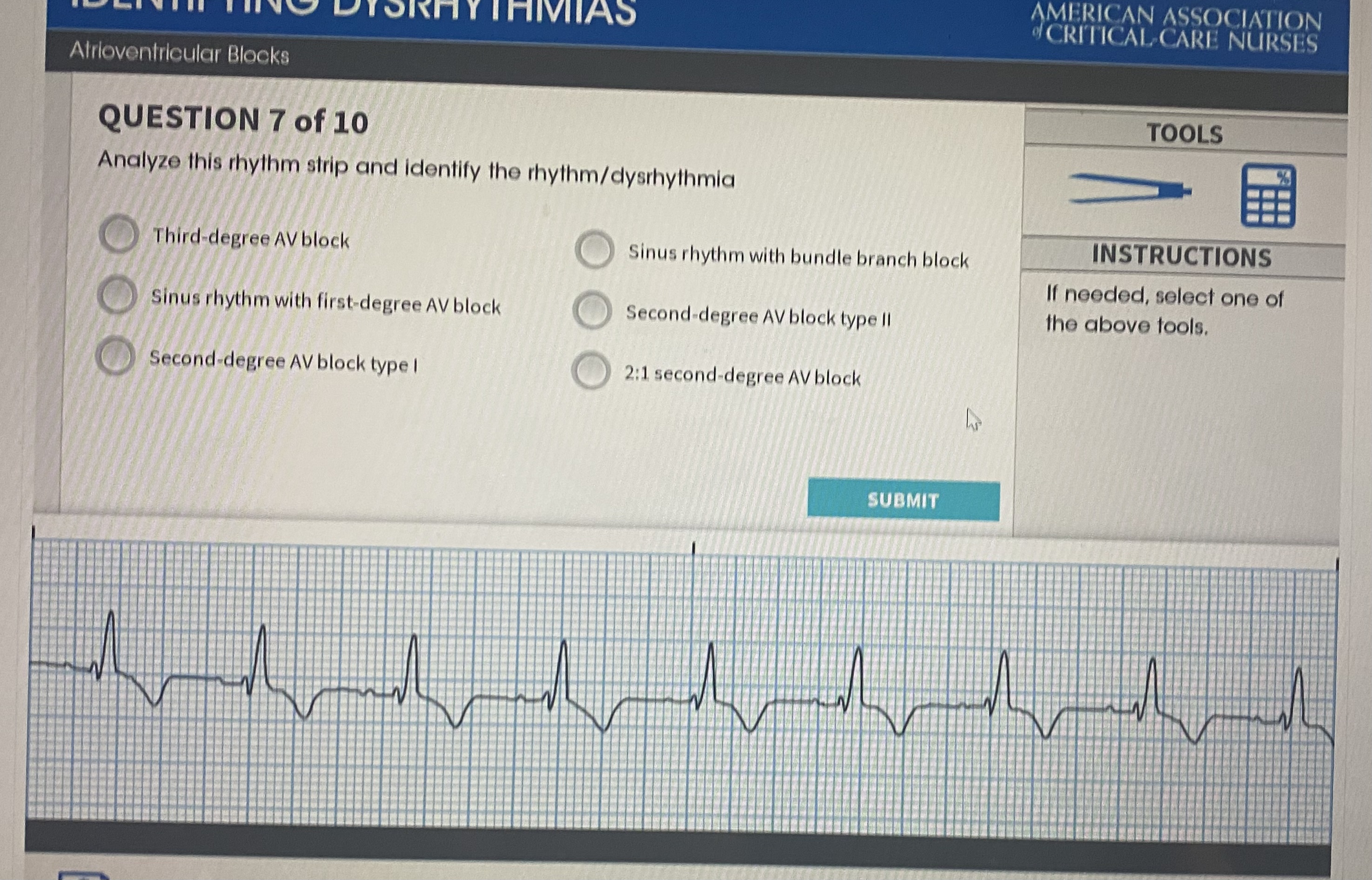 Analyze this rhythm strip and identify the | Chegg.com