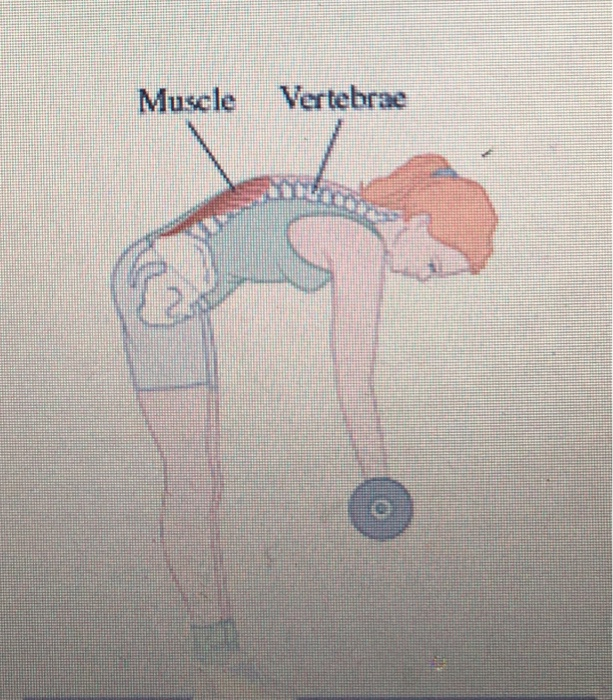 Solved Which expression below best describes the torque | Chegg.com