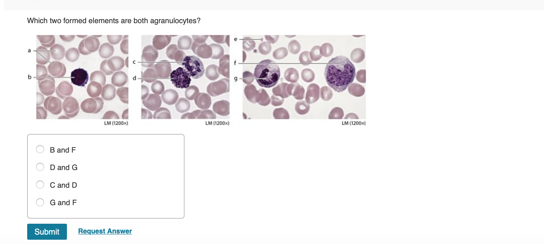 Solved Which two formed elements are both agranulocytes? LM | Chegg.com